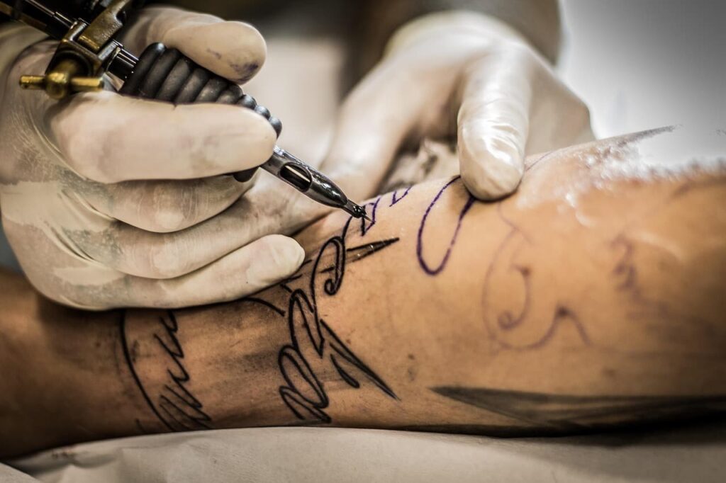 Moving On from Your Tattoo: The Options Compared