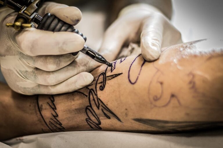 Moving On from Your Tattoo: The Options Compared